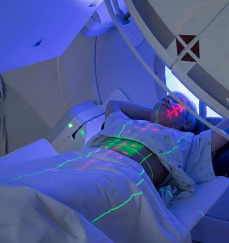 Radiation Therapy - sunsmileclinic.com.au